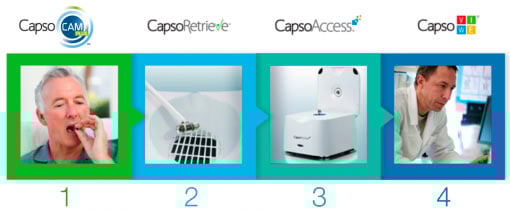 Kapselendoskopi av tynntarmen - Volvat